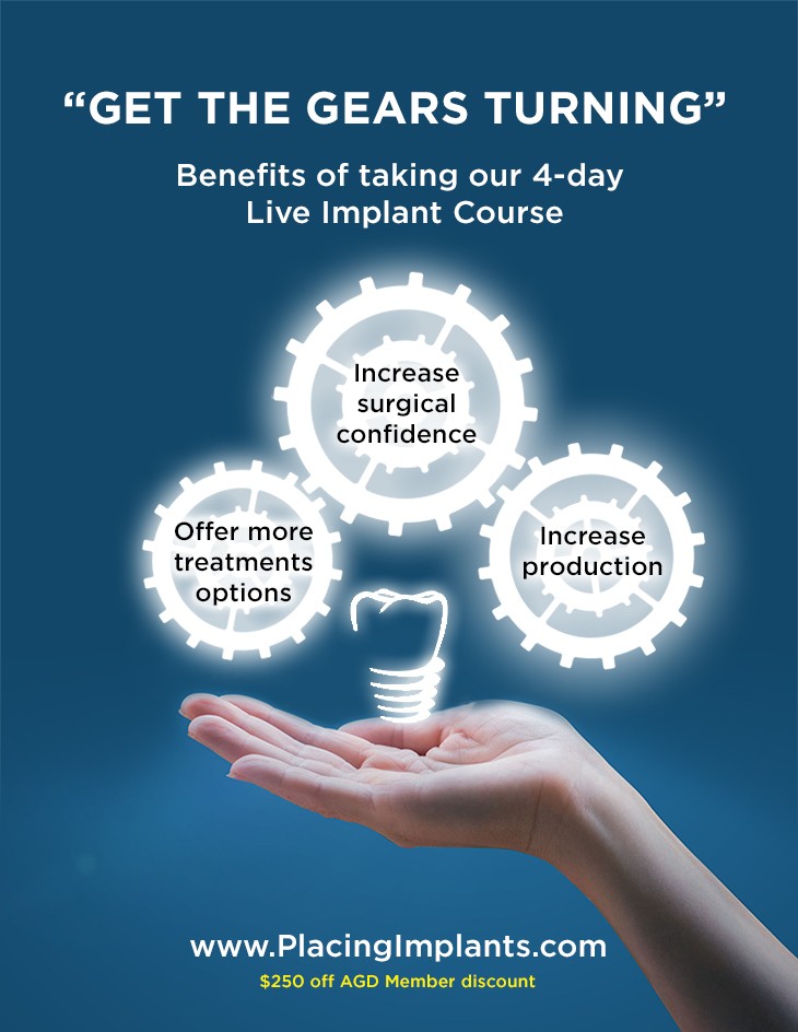 LIT-placing-implantsEBLASTCANADA | Live Implant Training ™ Work on ...