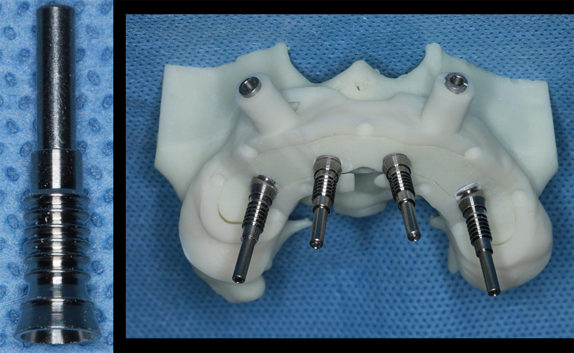 Stackable-surgical-guides-workshop-3 | Live Implant Training ™ Work on ...