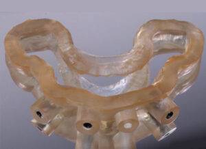 Live Implant Training ™ Work on Patients Dental Live Courses