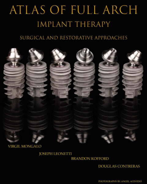 Dual Arch Smart on X full arches immediate loading | Live Implant ...