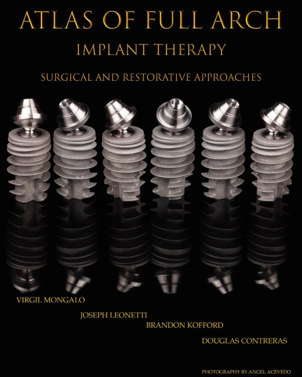 Dual Arch Smart on X full arches immediate loading | Live Implant ...